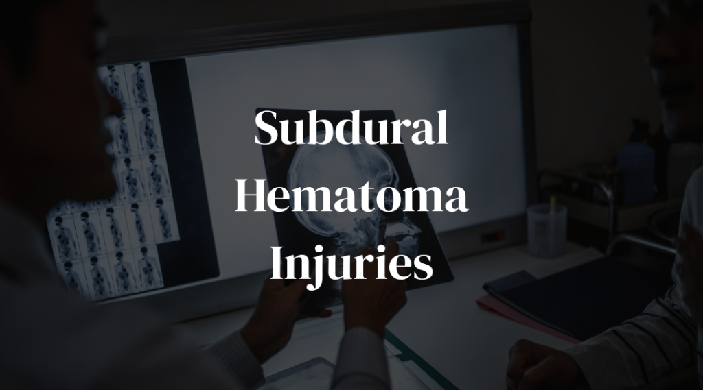 Subdural Hematoma Injuries | Miller and Hine Law